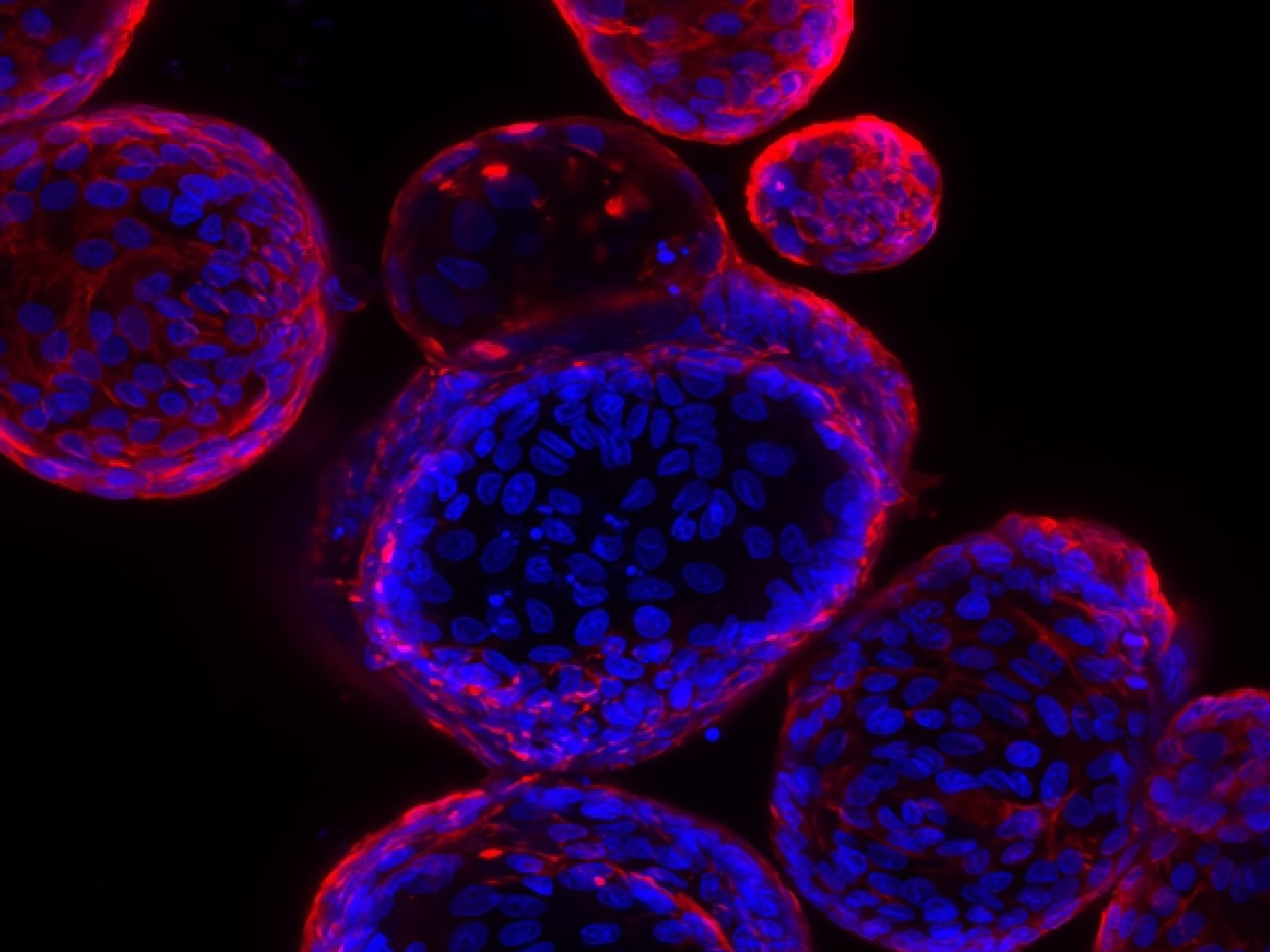 | Cellesce sale to Mollecular Devices: revolutionising drug discovery ...